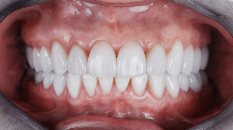 Enhance Your Smile: The Benefits of Cosmetic Dentistry - Expert Dental ...