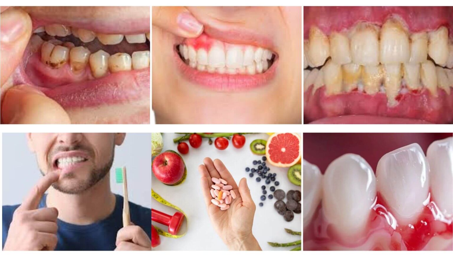 Bleeding Gums? Don’t Ignore the Warning Signs! - Expert Dental Care Blog